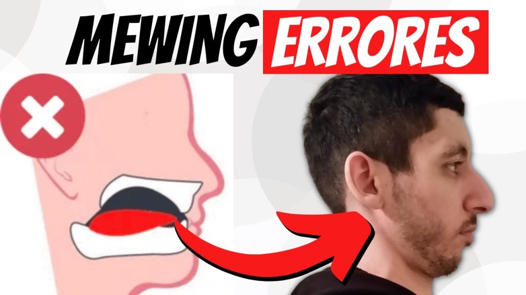 Liệu bạn có đang tập mewing đúng cách? Những dấu hiệu nhận biết